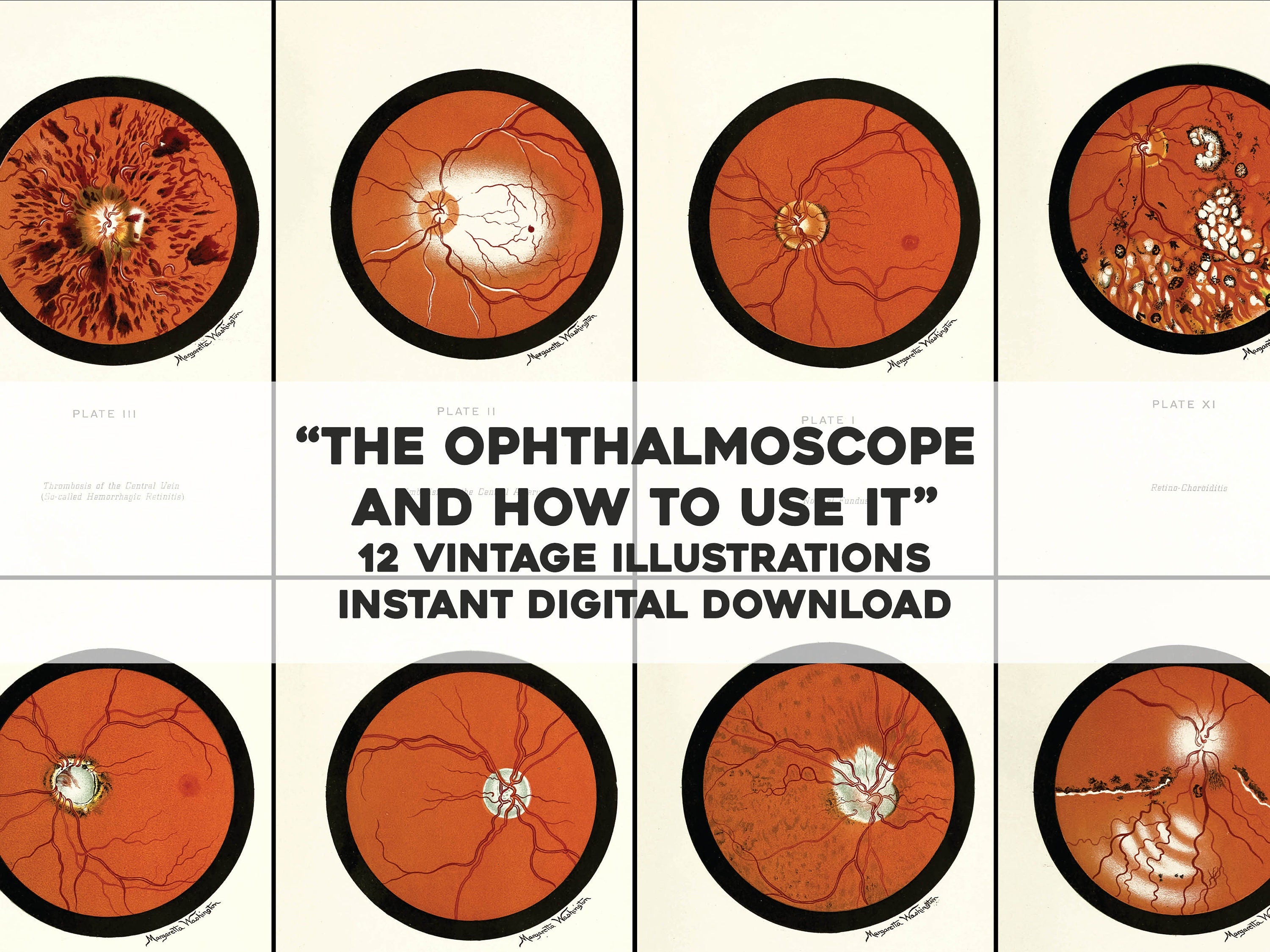The Ophthalmoscope and How to Use it | Anatomy Images - CleanArchives