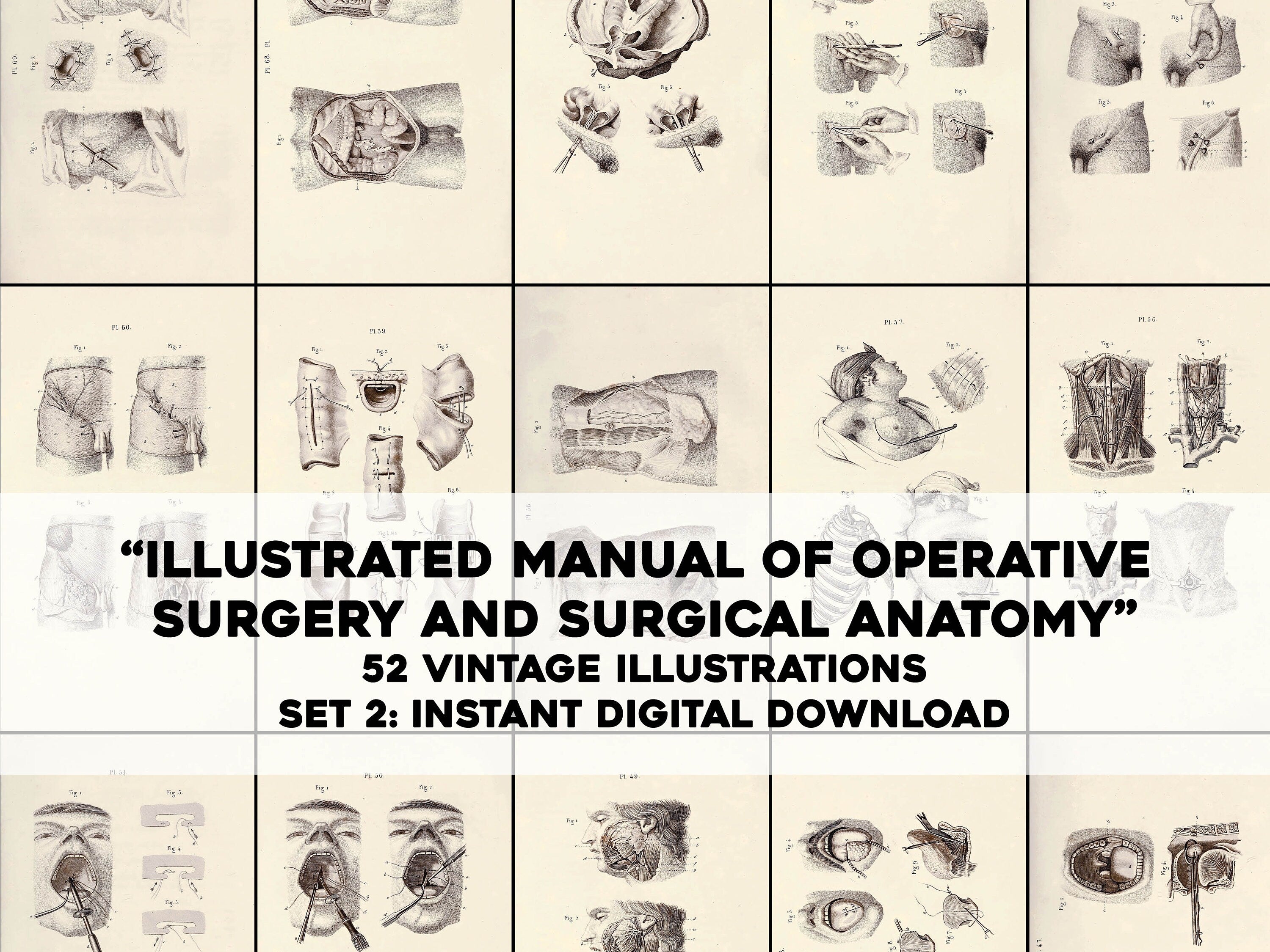 Illustrated Manual of Operative Surgery and Surgical Anatomy Set 2 ...