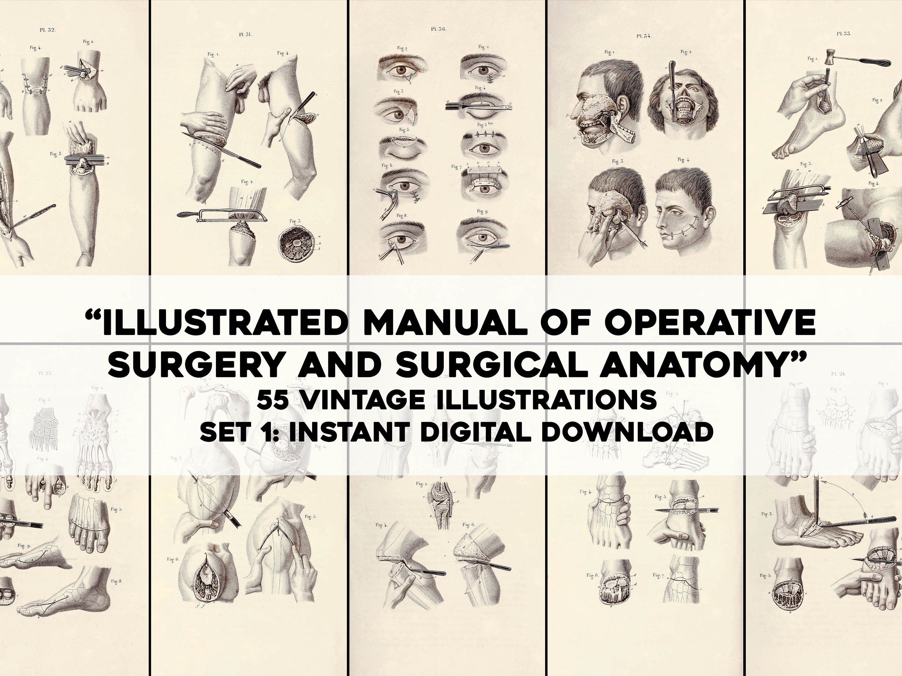 Illustrated Manual of Operative Surgery and Surgical Anatomy Set 1 ...